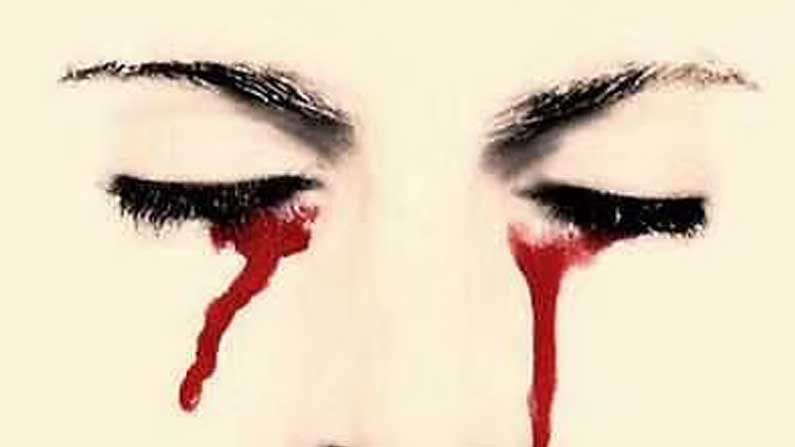 Tears of Blood: బహిష్టు సమయంలో ఆ మహిళ కంట రక్తం.. ఆశ్యర్యపోయిన వైద్యులు ...
