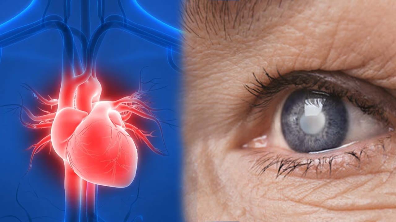Heart Attack: కంటికి సంబంధించి ఆ వ్యాధి ఉన్నవారికి గుండెజబ్బులు వచ్చే ...