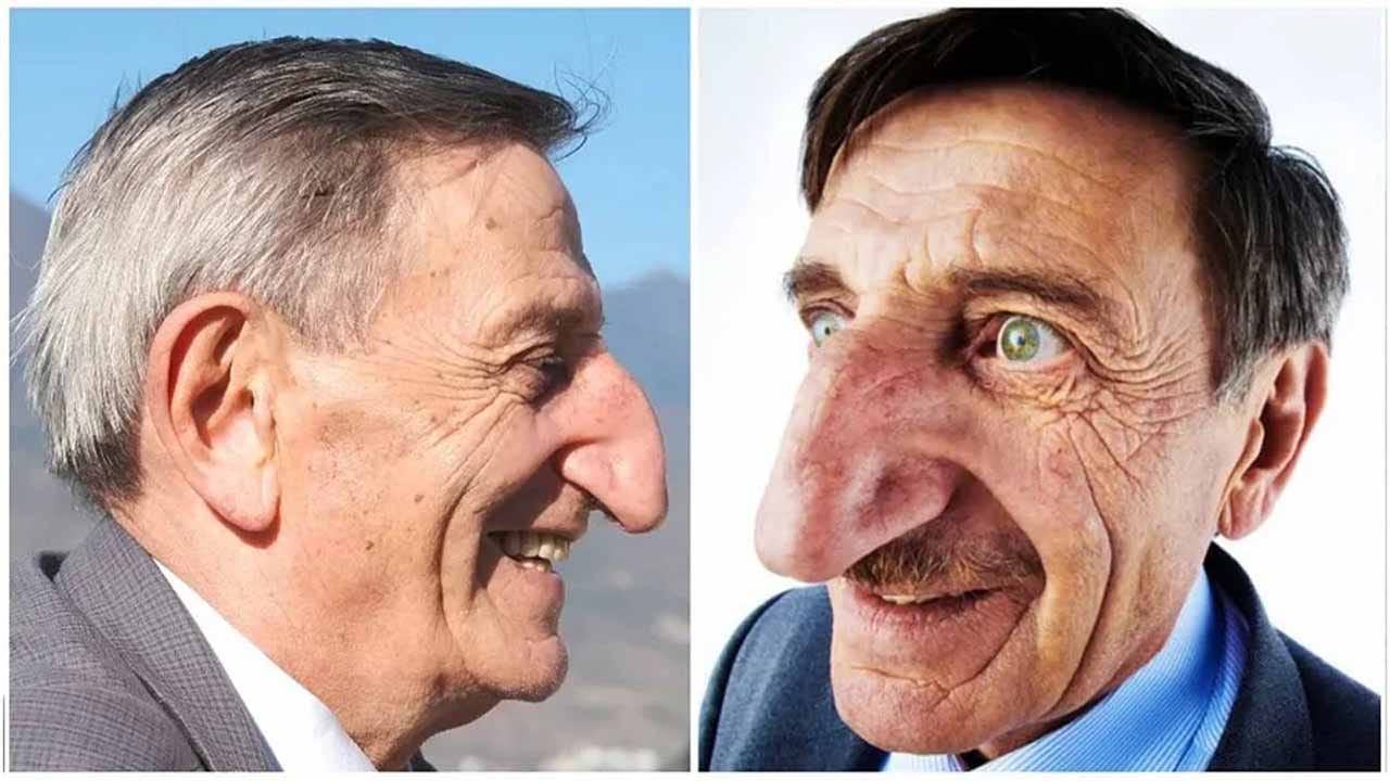 Longest Nose: ప్రపంచంలో అత్యంత పొడవైన ముక్కు ఉన్న వ్యక్తి ఎవరో తెలుసా ...
