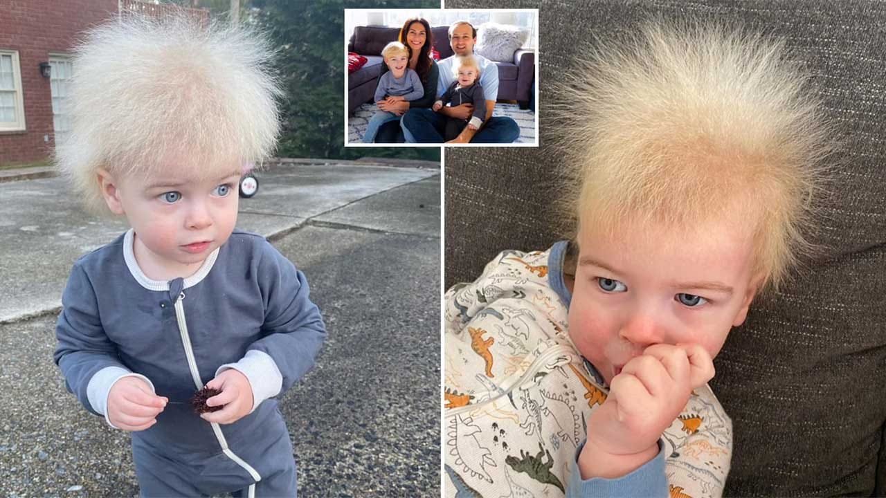 US Toddler: ప్రపంచంలో అరుదైన వ్యాధి బారిన పడిన చిన్నారి బాలుడు.. నయా ...