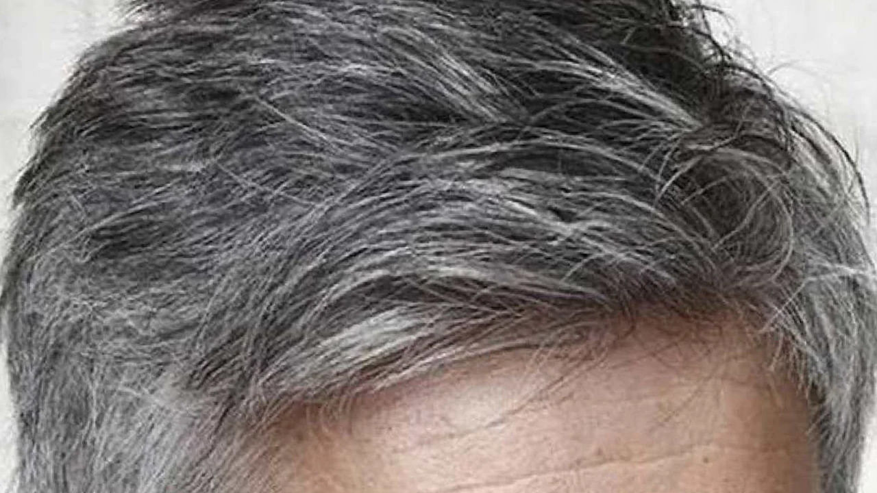 Hair Care: 20 ఏళ్లకే జుట్టు తెల్లబడుతుందా.. మీరు ఈ లోపం గురించి ...