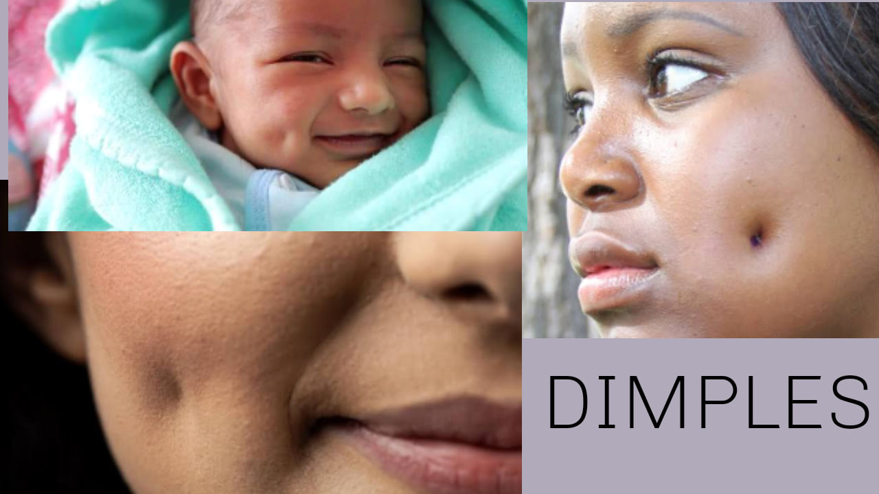 Dimple Cheeks: సొట్ట బుగ్గలు అంటేనే ప్రత్యేక ఆకర్షణ..! మరి వాటి వెనుక ఉన్న రహస్యం ఏమిటో తెలుసా ...