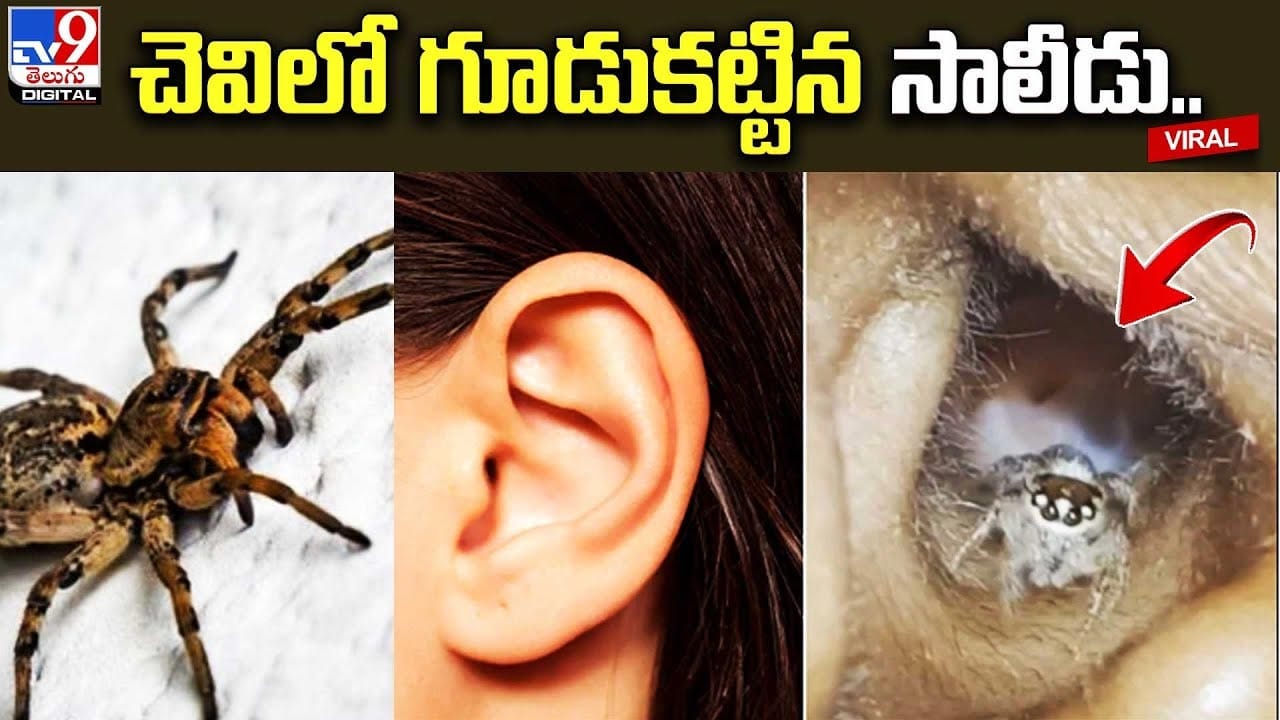 చెవినొప్పితో ఆస్పత్రికి వెళ్లిన యువతి.. స్కాన్‌ చేసి డాక్టర్‌ షాక్ ...