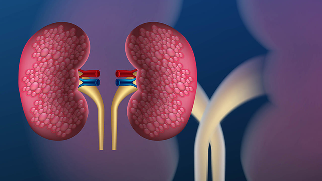 Kidney Health: శరీరంలో ఇలాంటి లక్షణాలు కనిపిస్తే మీ కిడ్నీలు ...