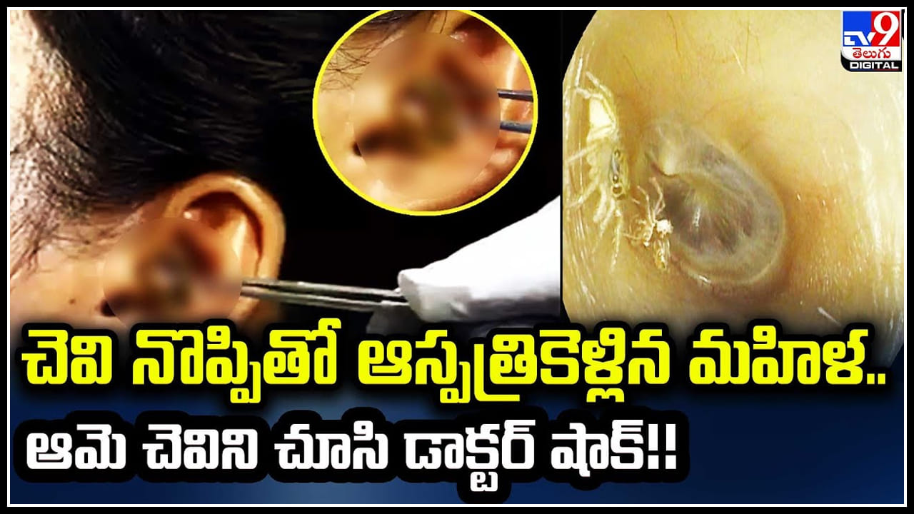 Spider in Ear: చెవి నొప్పితో ఆస్పత్రికెళ్లిన మహిళ.. ఆమె చెవిని చూసి ...