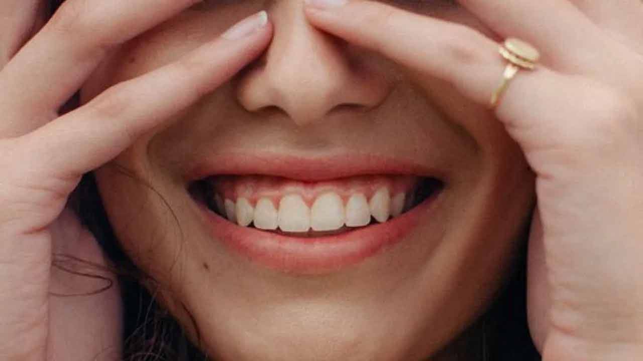 Teeth Care Tips: దంతాలపై పసుపు రంగును మాయం చేసే ఆహారాలు ఇవే.. వీటిని ...