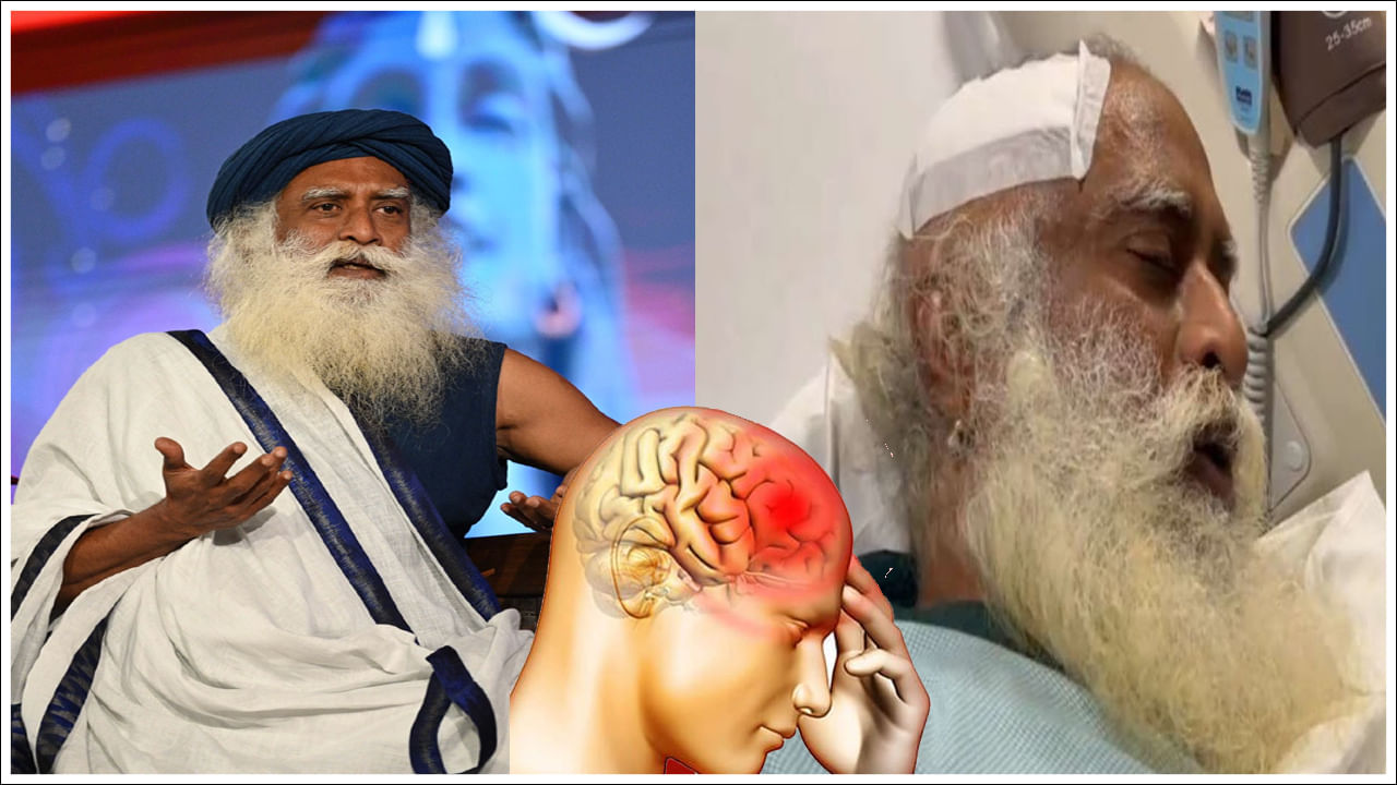 Brain Surgery: తలనొప్పి కారణంగా సద్గురుకు బ్రెయిన్‌ సర్జరీ.. మీకు ఇలాంటి తలనొప్పి ఉంటే ...