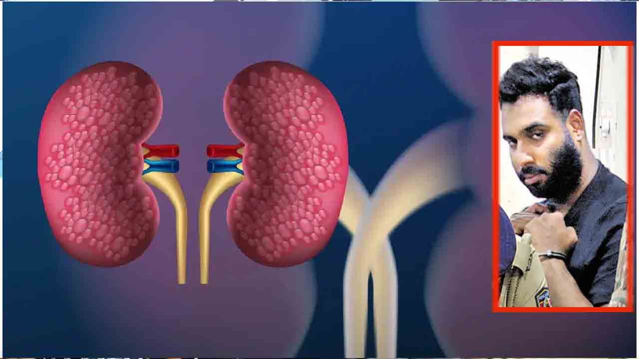 Kidney Racket: వీడుతున్న గుట్టు.. అంగట్లో కిడ్నీలు.. కేరళ టూ హైదరాబాద్ ...