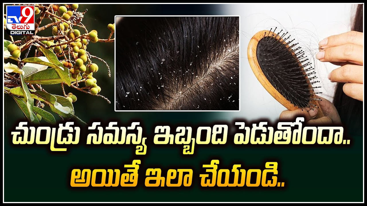 Dandruff Problem: చుండ్రు సమస్య ఇబ్బంది పెడుతోందా.. అయితే ఇలా చేయండి ...