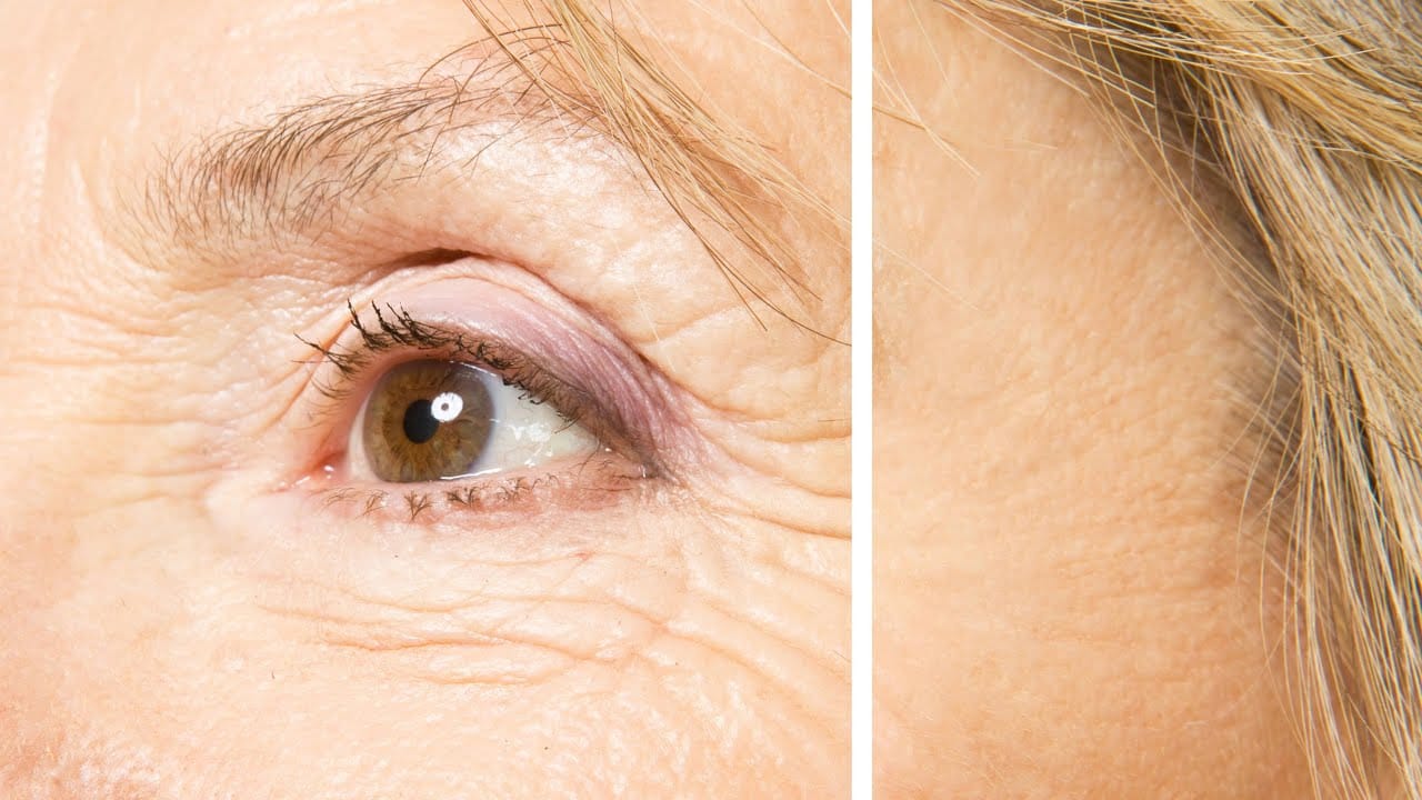 Tips for Wrinkles: ఇలా చేశారంటే ముఖంపై ముడతలు ఈజీగా తగ్గించుకోవచ్చు ...
