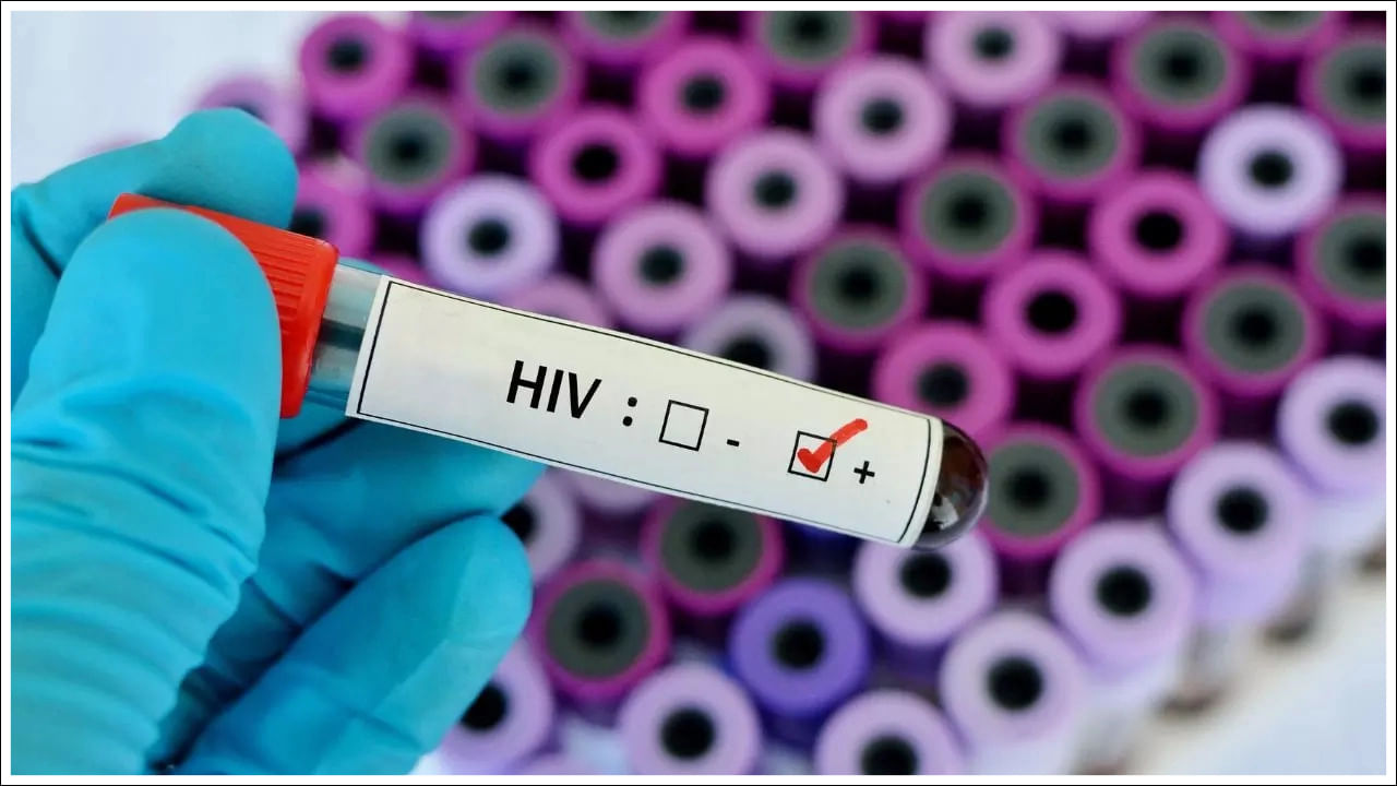 HIV Infection: ఆ రాష్ట్రంలో 800 మందికి పైగా విద్యార్థులకు హెచ్‌ఐవీ పాజిటివ్.. 47 మంది మృతి ...