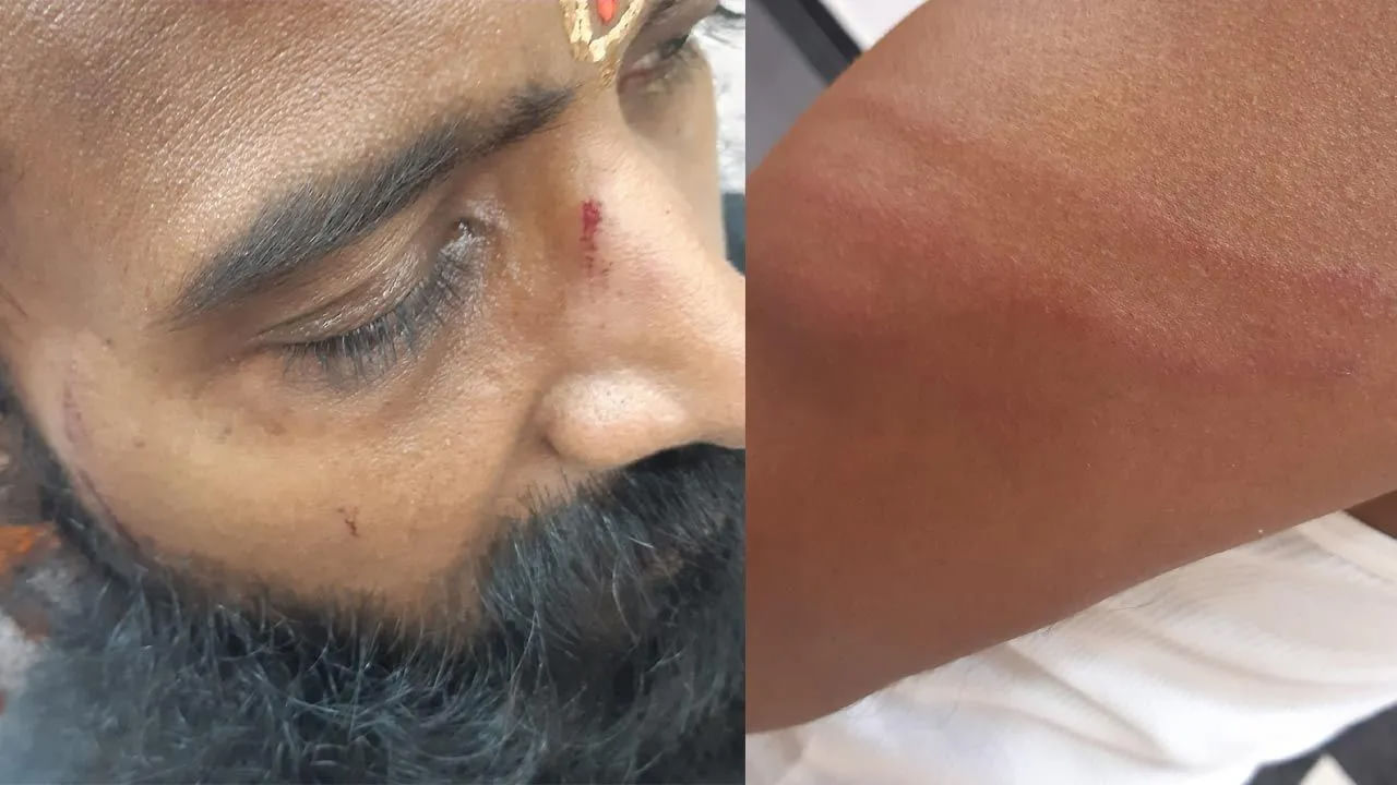 Veera Raghava Reddy : రామరాజ్యం వీర రాఘవరెడ్డిపై దాడి.. వాతలు తేలేలా ...