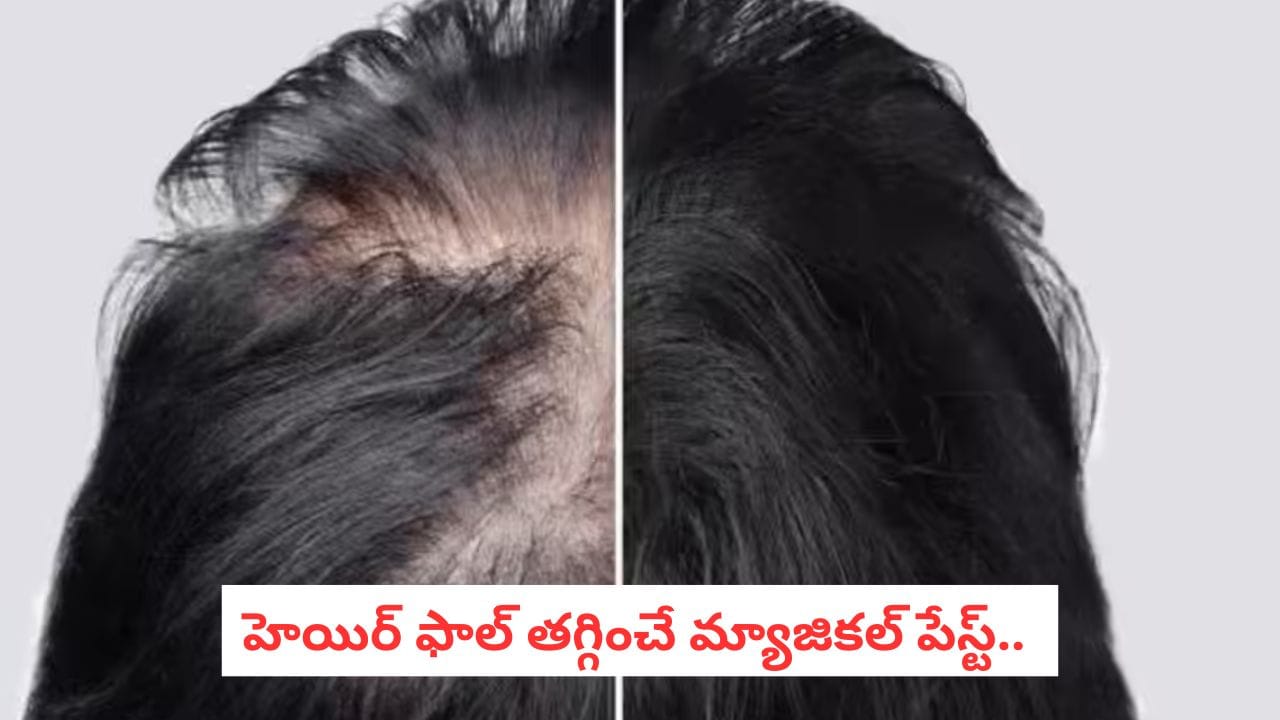 Hair Fall: జుట్టు గుత్తులుగా రాలుతుందా? హెయిర్ ఫాల్‌ను బ్రేక్ ...