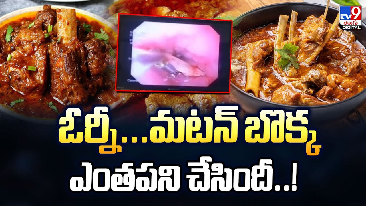 ఓర్నీ.. మటన్‌ బొక్క ఎంతపని చేసిందీ - Telugu News | Choking Hazard ...